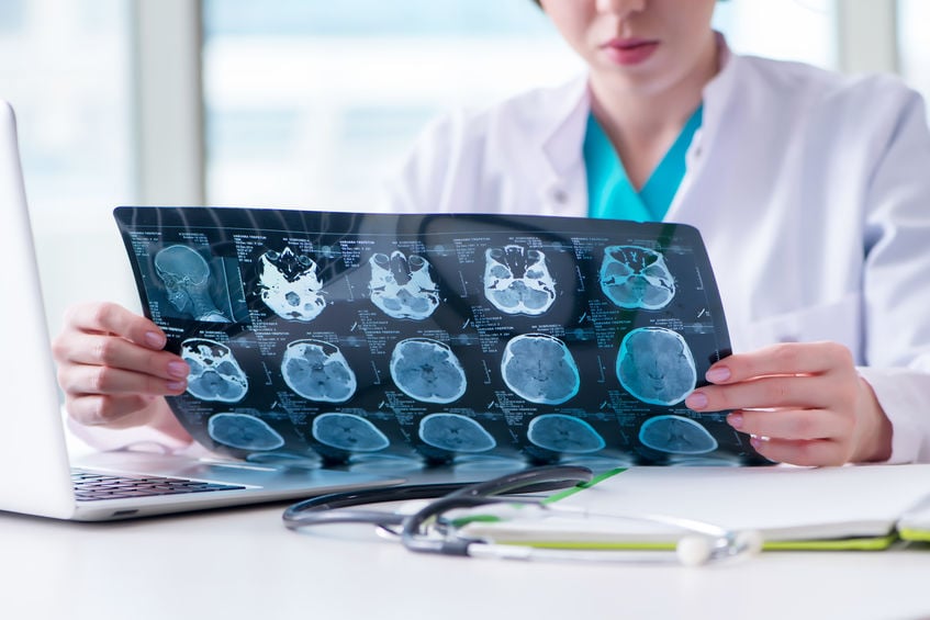 Idiopathic Intracranial Hypertension. Vision at Risk.