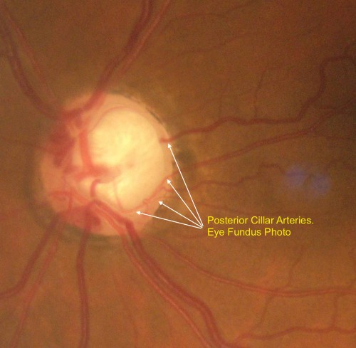 What is NAION and Is Eyesight Loss Irreversible? Research and Practice